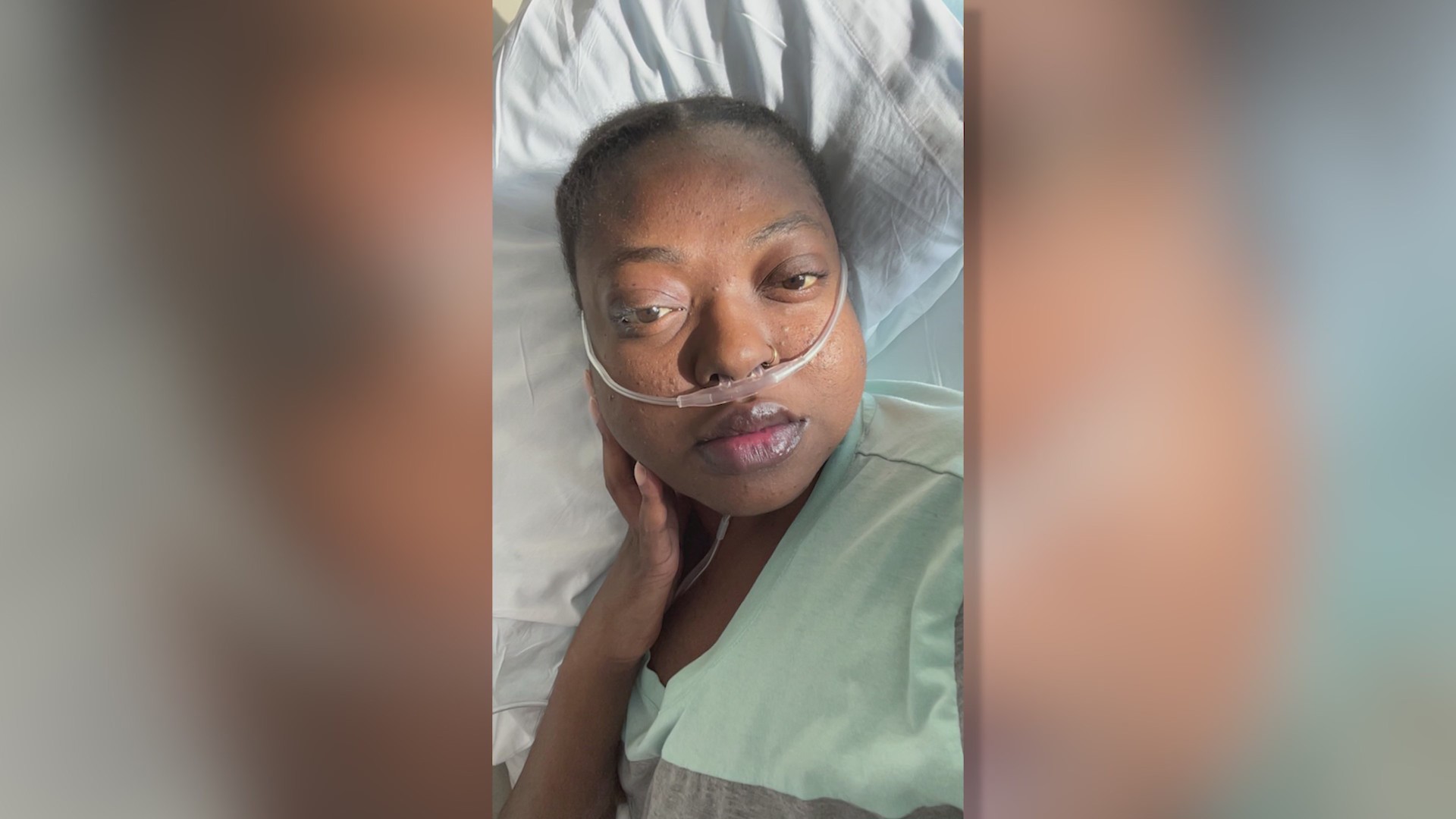 Woman receives rare quadruple organ transplant at UChicago Medicine ...