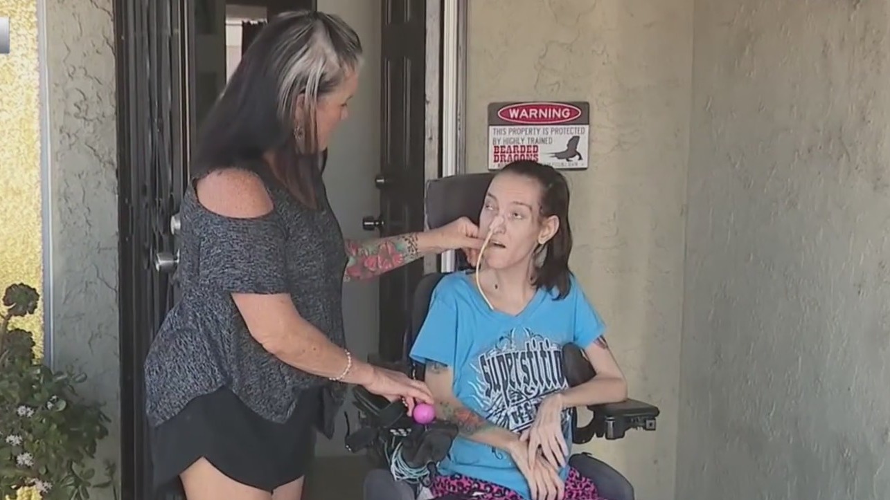 Kaiser strike having an impact on patients – FOX 5 San Diego & KUSI News
