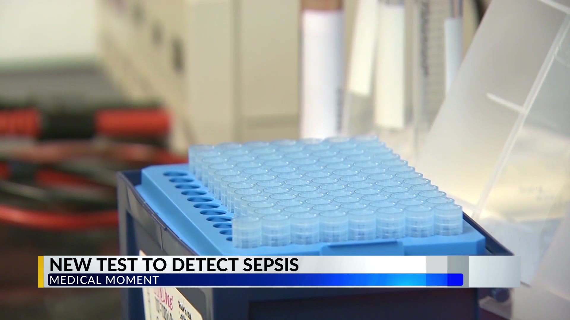 Medical Moment: New Test to Detect Sepsis with USA Health’s Dr. Edward ...
