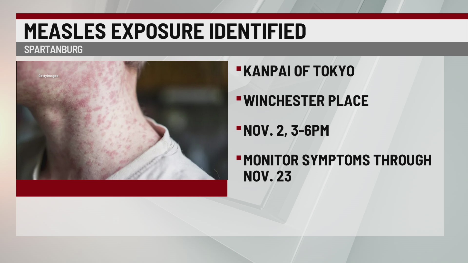 Spartanburg restaurant exposed to measles case – WSPA 7NEWS
