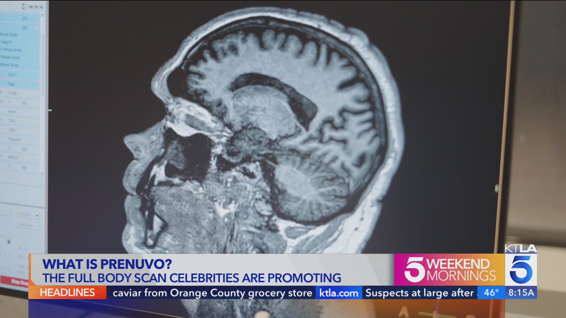 Prenuvo CEO Andrew Lacy Stops by the KTLA Weekend Morning News to Talk ...