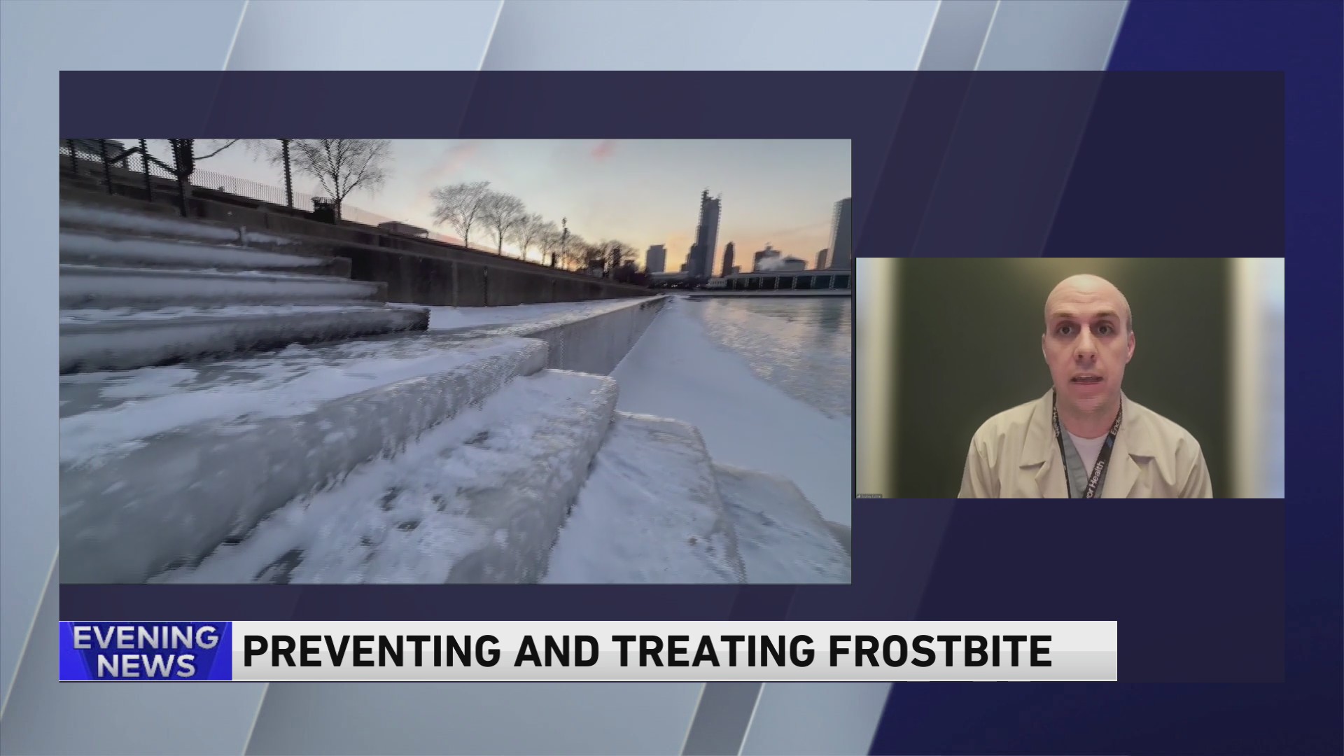 Prevent frostbite: Essential steps to protect skin in extreme cold – WGN-TV