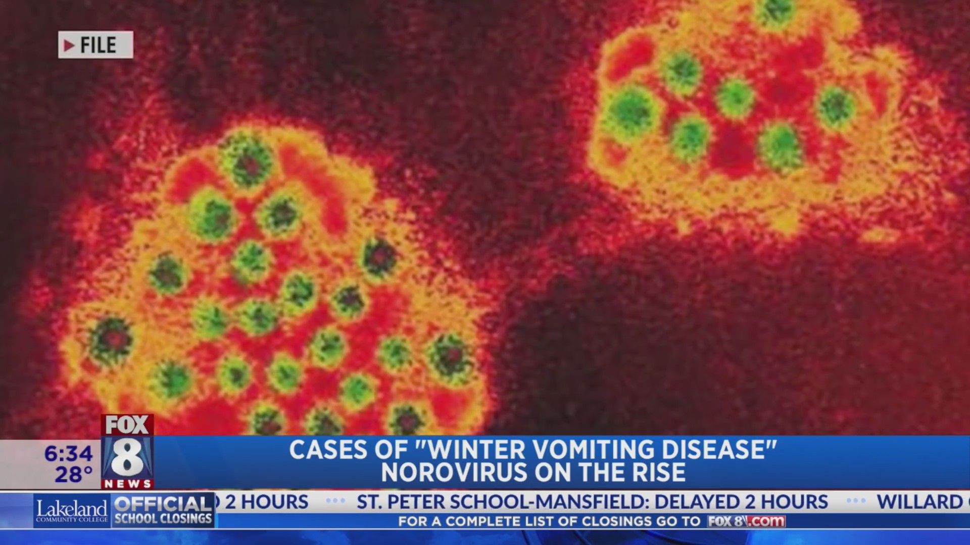 Winter vomiting disease cases on the rise – Fox 8 Cleveland WJW